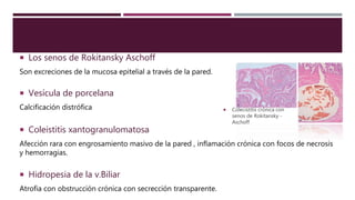 Vesicula biliar - Elyz Ariadneth Cortez López | PPTX