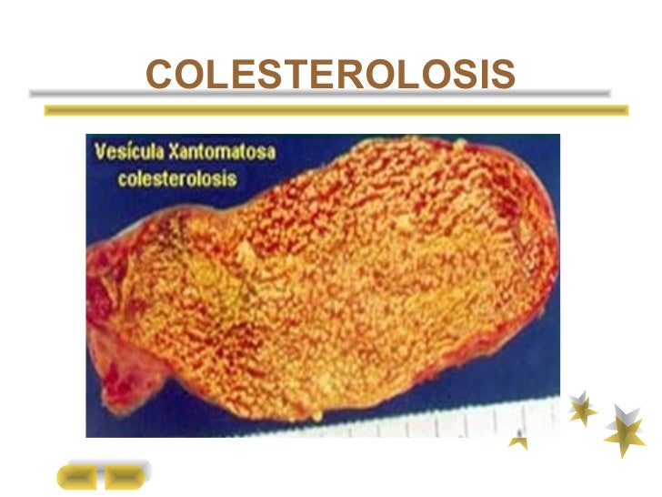 RADIOLOGIA Vesicula biliar y vias biliares DRA MARROQUIN