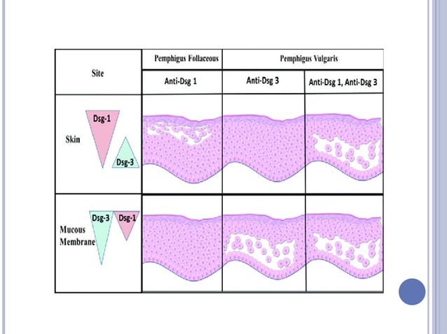 VESICULAR AND BULLOUS LESIONS OF SKIN (2).pptx | Skin and Dermatology ...