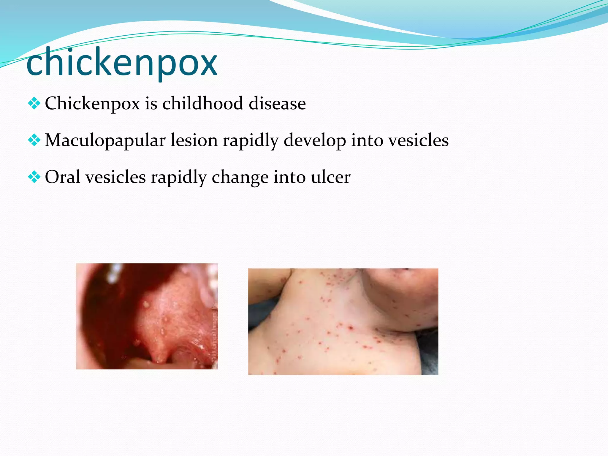 Vesicular and bullous lesions power point | PPTX