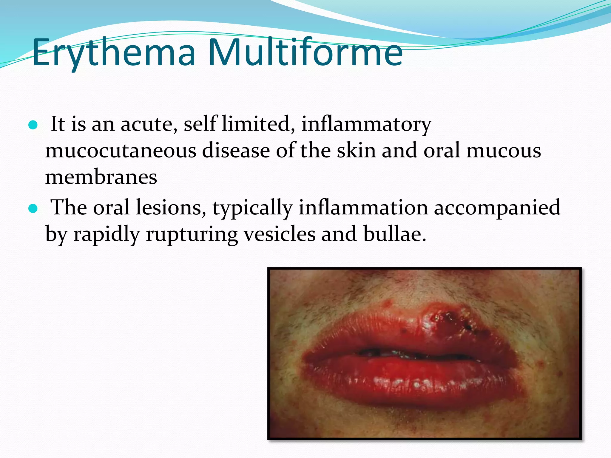 Vesicular and bullous lesions power point | PPTX