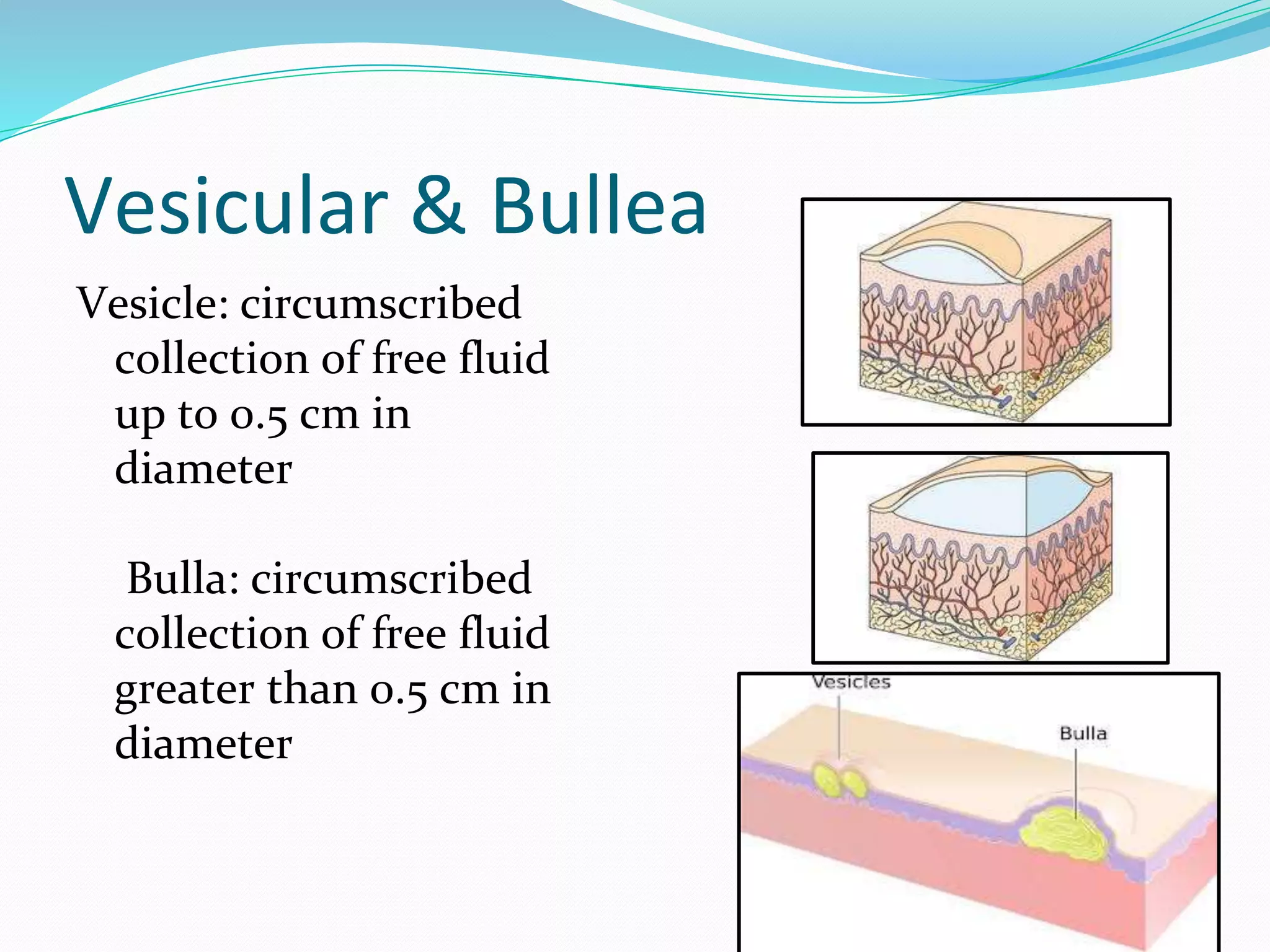 Vesicular and bullous lesions power point | PPTX