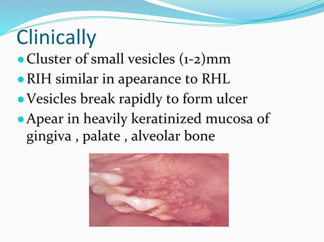 Vesicular and bullous lesions power point | PPTX
