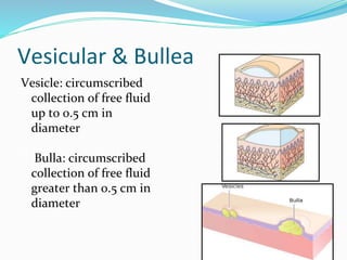 Vesicular and bullous lesions power point | PPTX