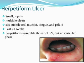 Vesicular and bullous lesions power point | PPTX
