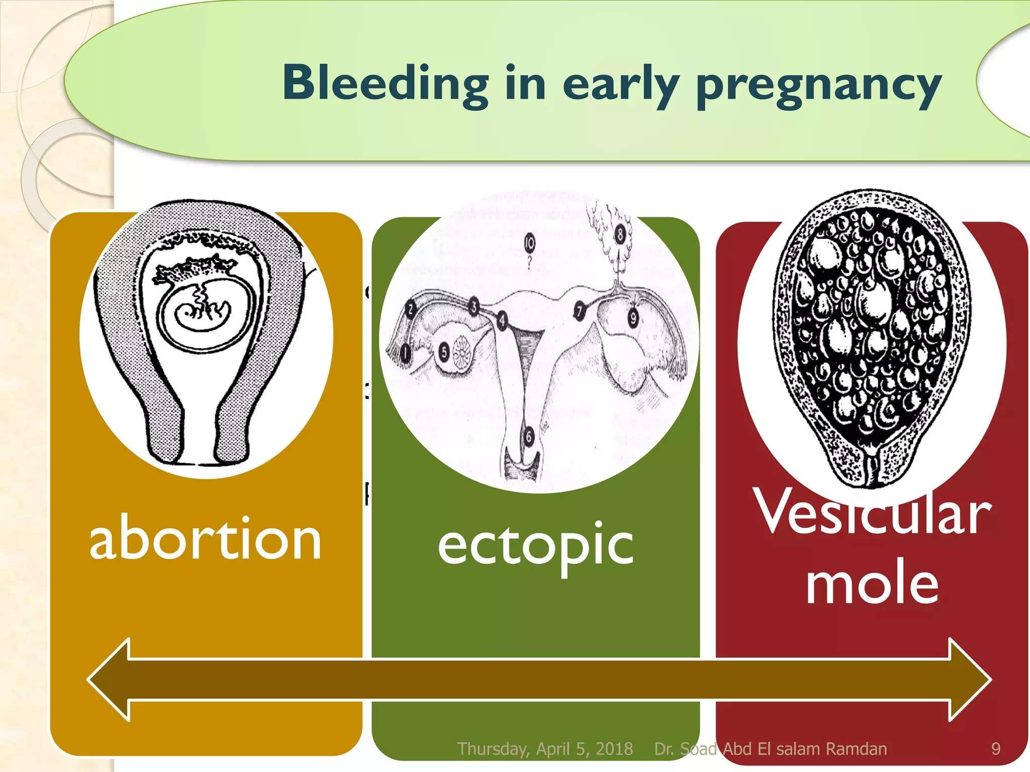 Vesicular mole | PDF