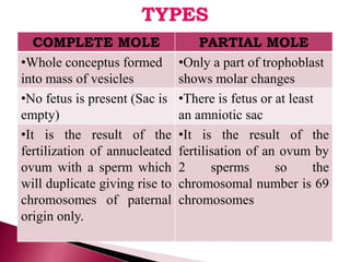 vesicular mole.pptx