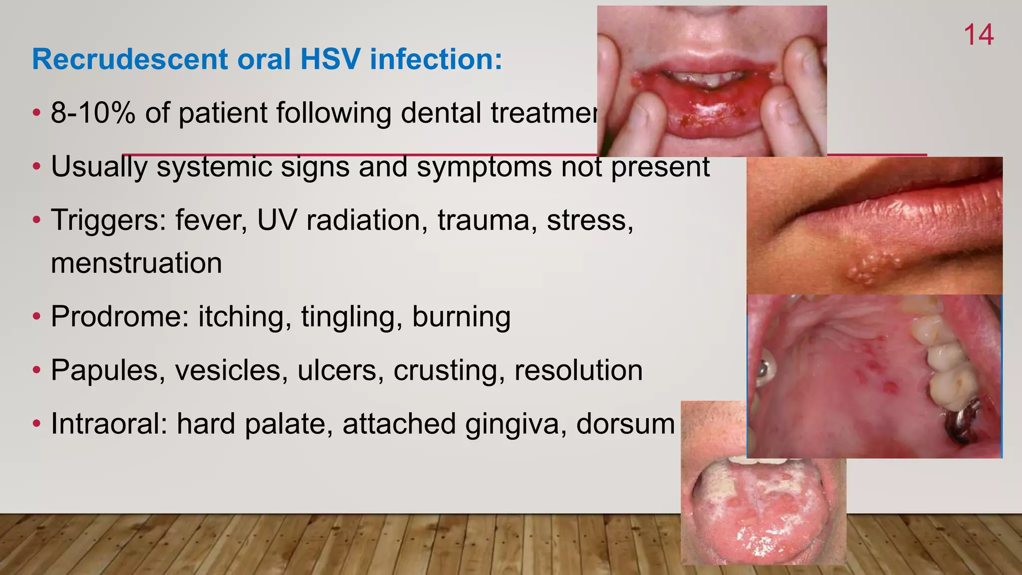 Vesiculo bullous lesions of oral cavity | PPTX