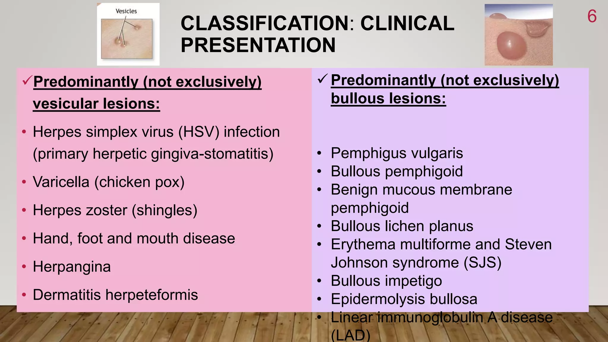 Vesiculo bullous lesions of oral cavity | PPTX