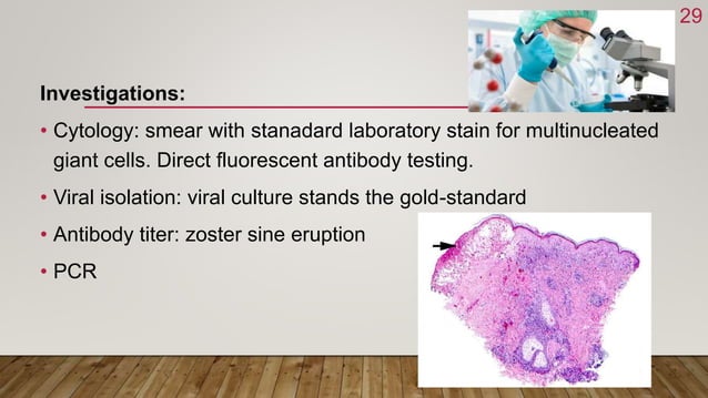 Vesiculo bullous lesions of oral cavity | PPTX | Infectious Diseases ...
