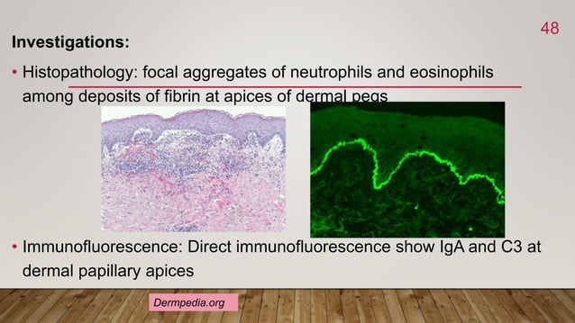 Vesiculo bullous lesions of oral cavity | PPTX | Infectious Diseases ...