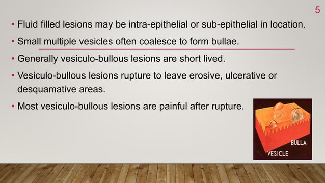 Vesiculo bullous lesions of oral cavity | PPTX | Infectious Diseases ...