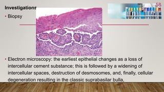 Vesiculo bullous lesions of oral cavity | PPTX