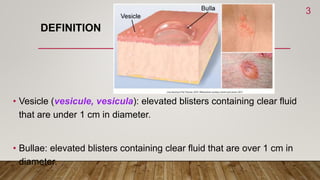 Vesicles Definition