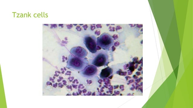 Vesiculo bullous diseases | PPTX | Skin and Dermatology | Diseases and ...