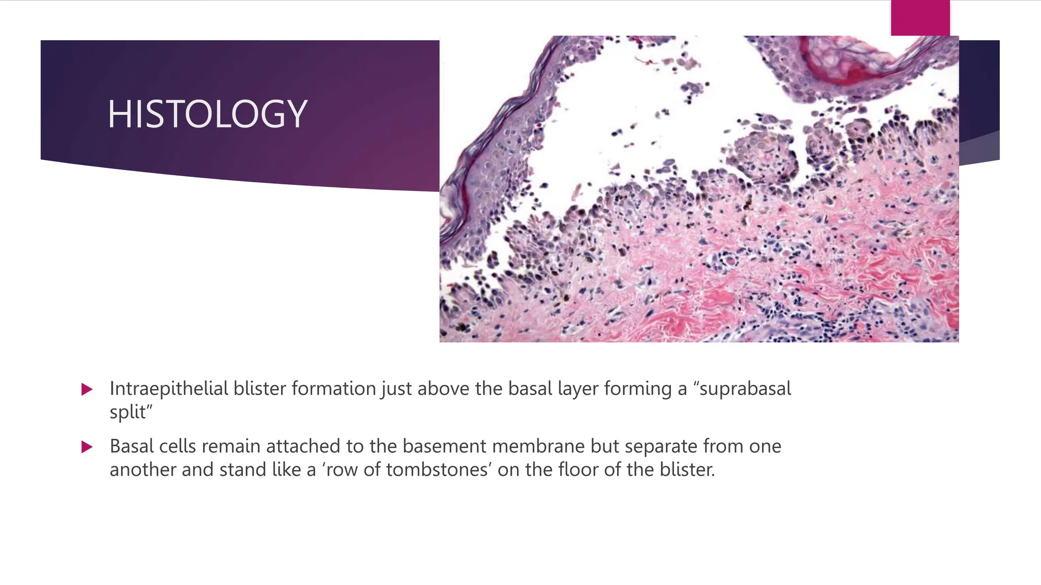 VESICULOBULLOUS DISORDERS- INTRAEPIDERMAL SPLIT | PPTX | Skin and ...