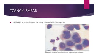 VESICULOBULLOUS DISORDERS- INTRAEPIDERMAL SPLIT | PPTX