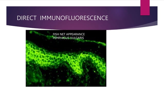 VESICULOBULLOUS DISORDERS- INTRAEPIDERMAL SPLIT | PPT