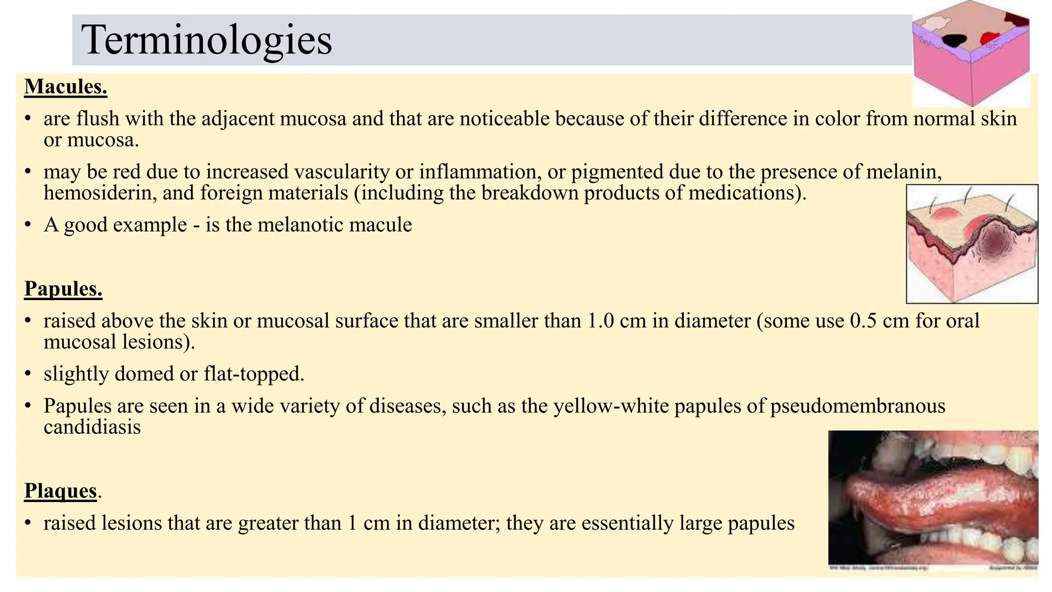 Vesiculobullous lesion of oral cavity.pptx