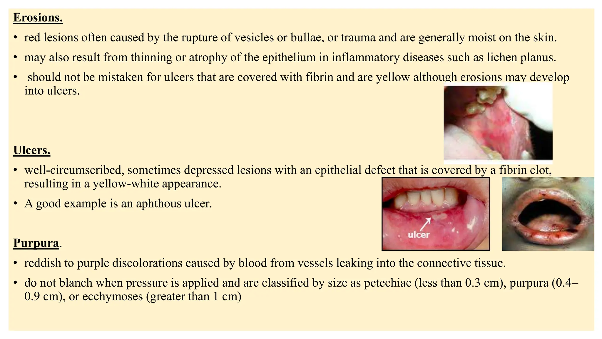 Vesiculobullous lesion of oral cavity.pptx