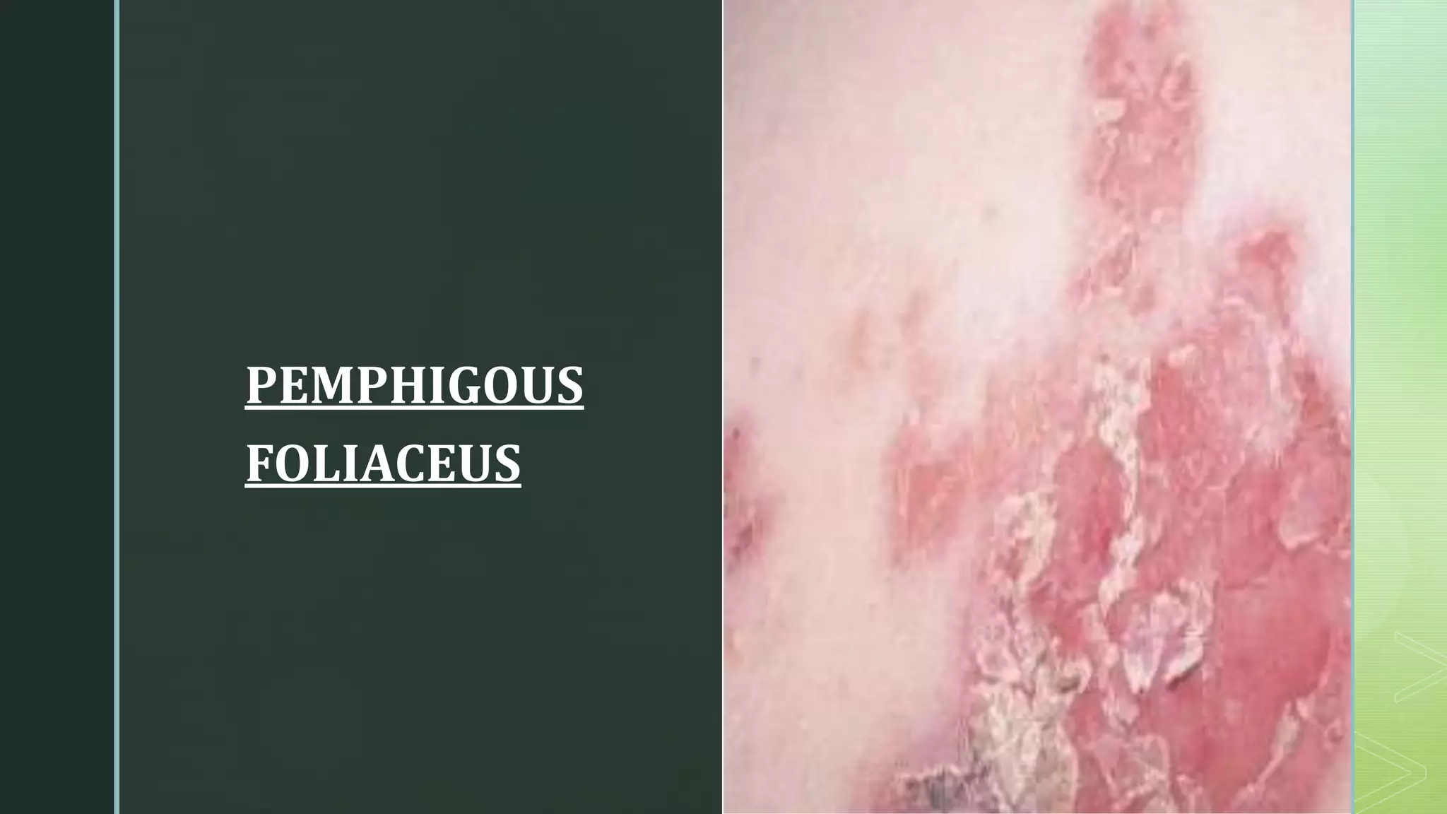 VESICULO BULLOUS LESIONS | PPTX