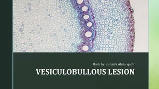 VESICULO BULLOUS LESIONS | PPTX