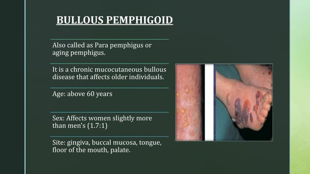 VESICULO BULLOUS LESIONS | PPTX