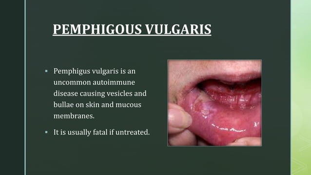 VESICULO BULLOUS LESIONS | PPTX
