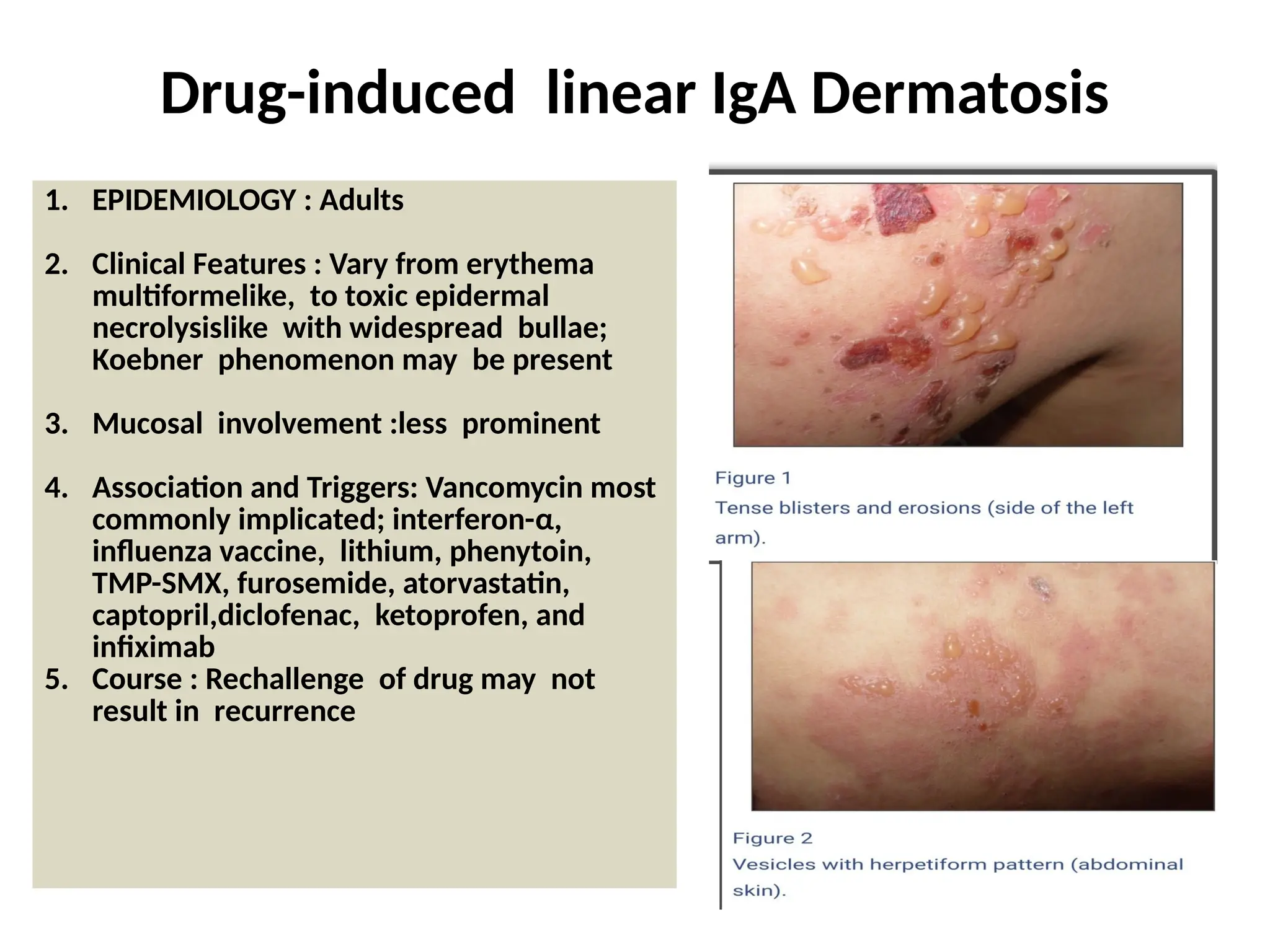 bullous dermatosis in dermatology part 2.pptx