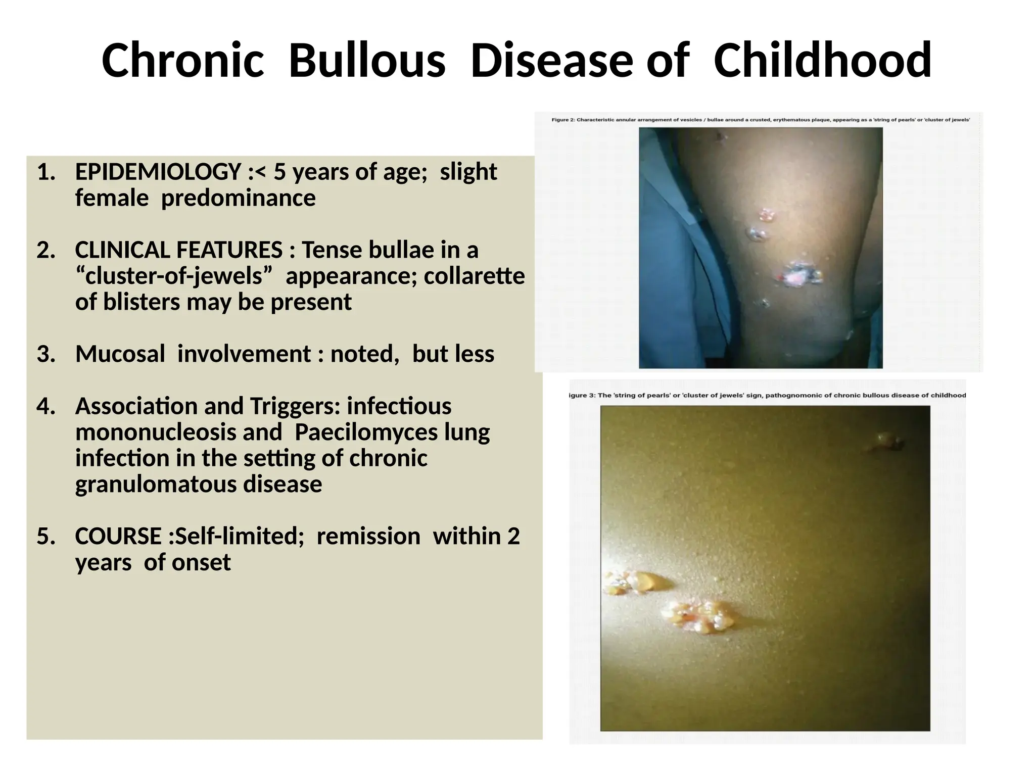 bullous dermatosis in dermatology part 2.pptx