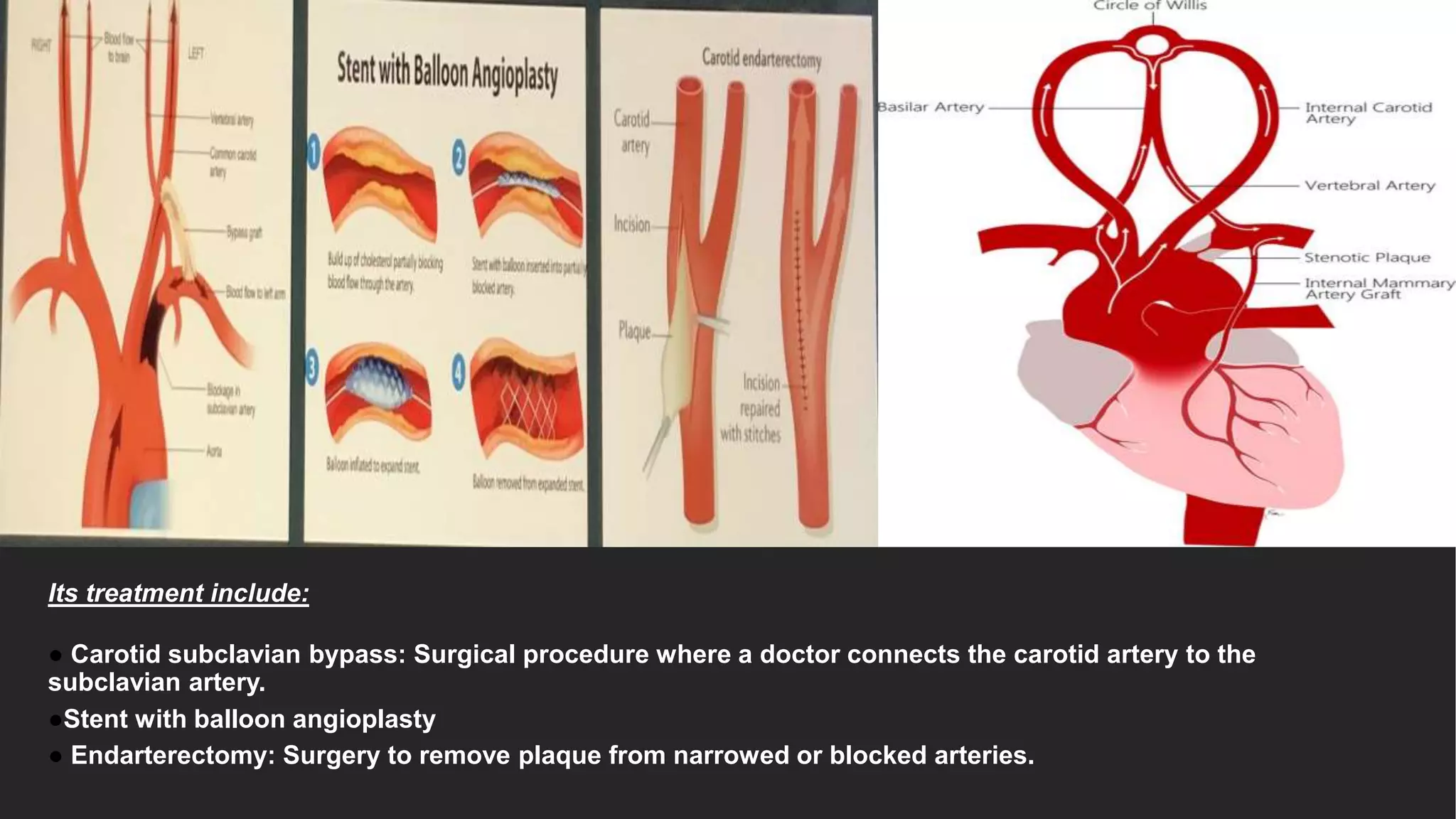 Vessels of upper limb..pptx