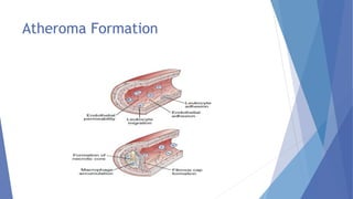 Vessel Wall Biology & Atherosclerosis.pptx