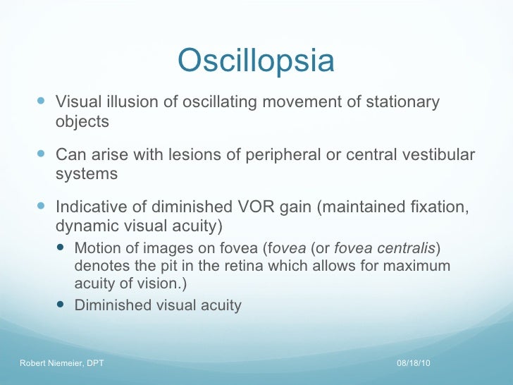 Vestibular Issues in PT