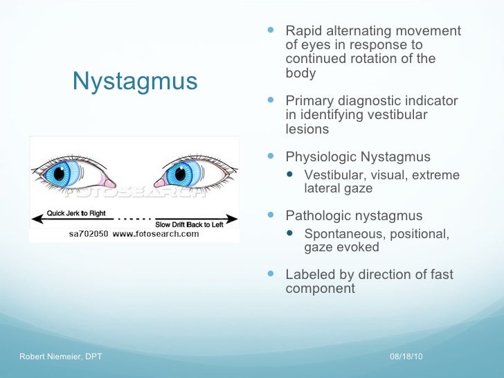 Vestibular Issues in PT