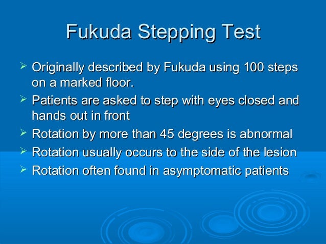 vertigo and the Vestibular system