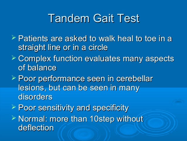 vertigo and the Vestibular system