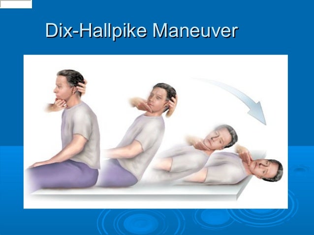 vertigo and the Vestibular system