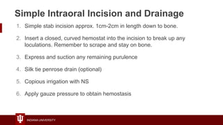 Vestibular Abscess.pptx