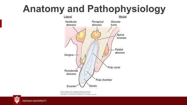 Vestibular Abscess.pptx | Ear, Nose and Throat Conditions | Diseases ...