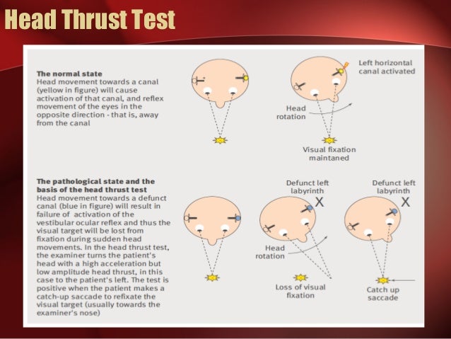Vestibular assessment