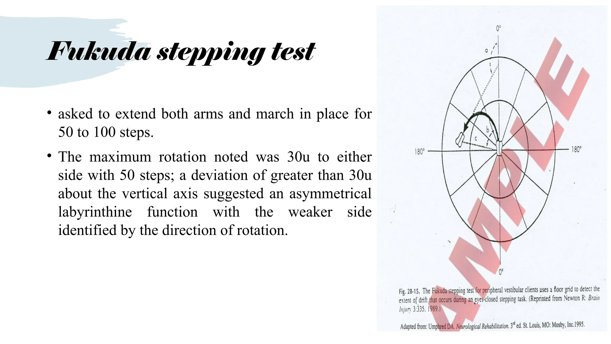 VESTIBULAR ASSESSMENT AND MANAGEMENT 2.pptx