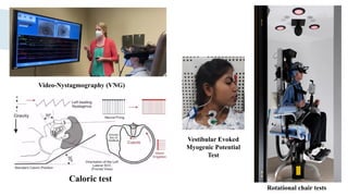 VESTIBULAR ASSESSMENT AND MANAGEMENT 2.pptx