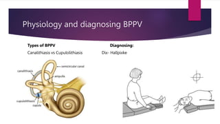vestibular audiology.pptx