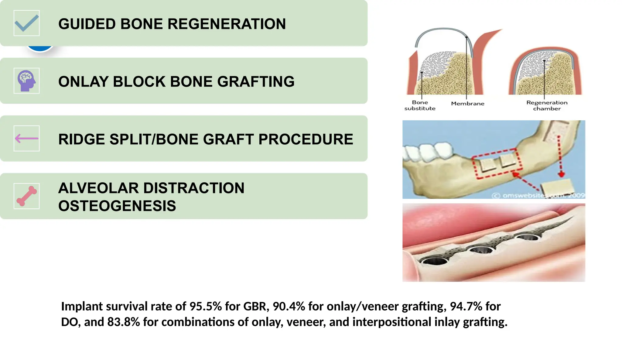 VESTIBULAR AUGMENTATION 3 dimensional printed bone graft | PPTX