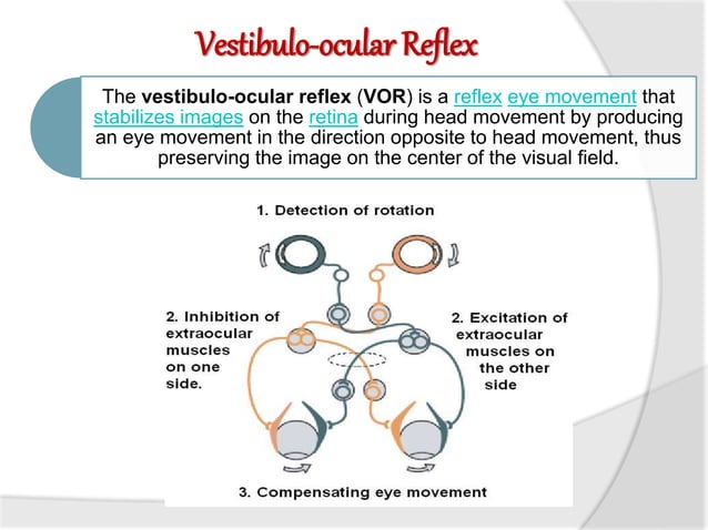 Vestibular disorder 1 (1).pptx