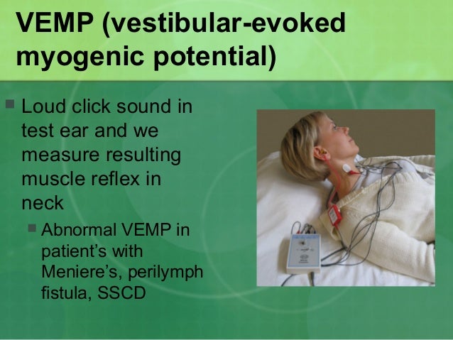 Vestibular disorders