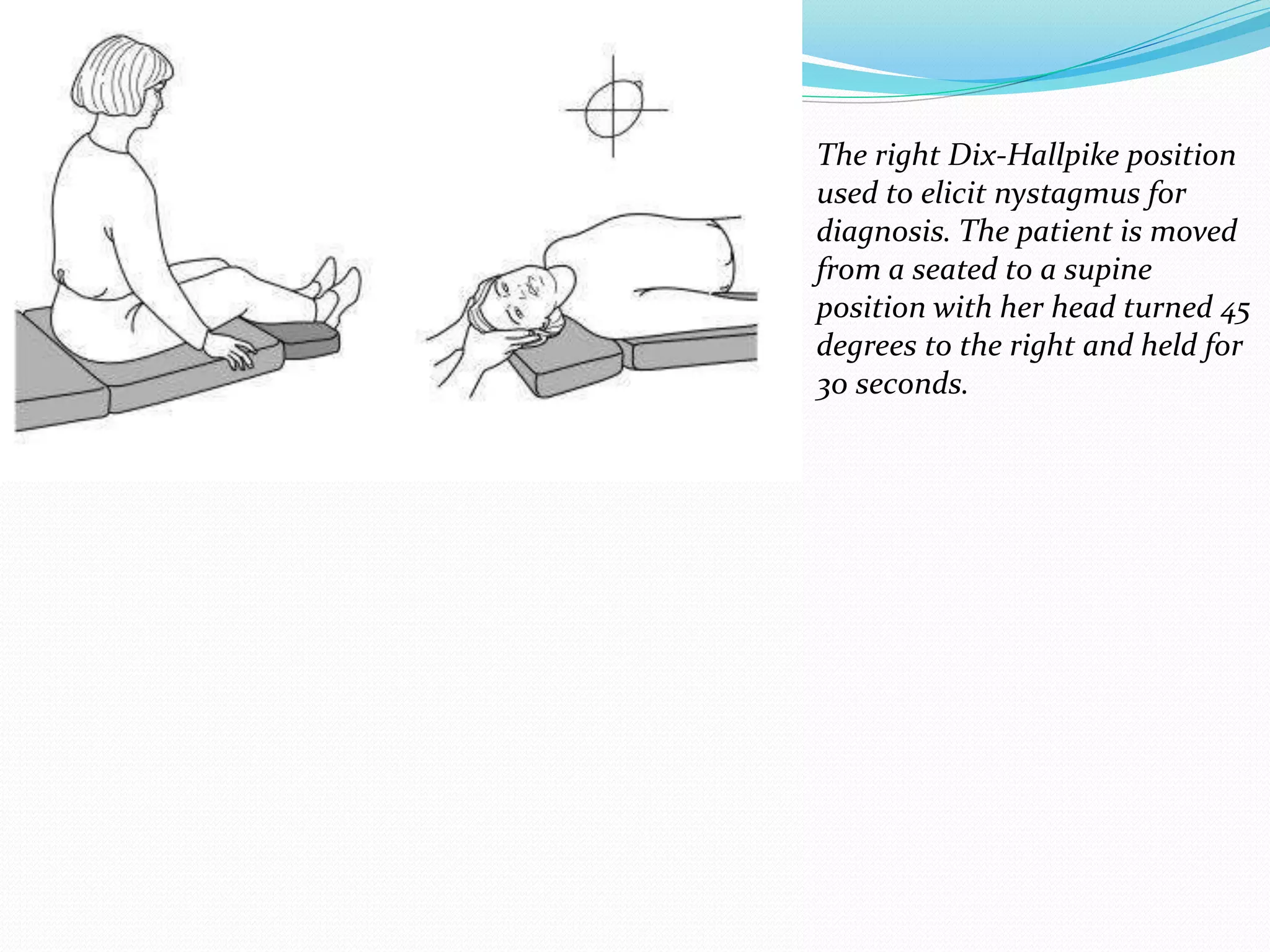 Vestibular disorders and rehabilitation | PPTX