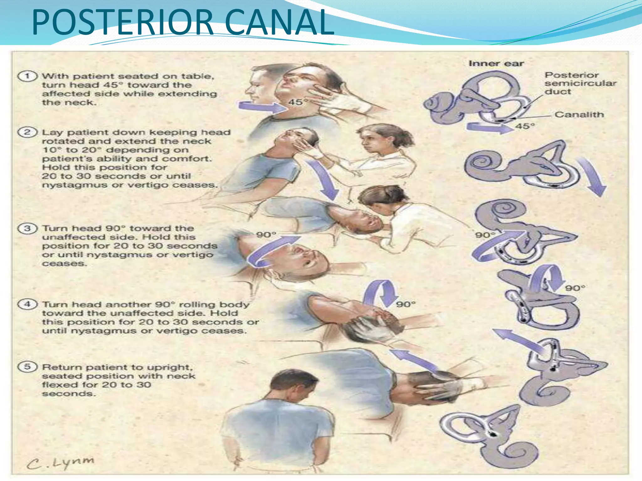 Vestibular disorders and rehabilitation | PPTX