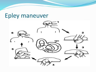 Vestibular disorders and rehabilitation | PPTX | Brain and Nervous ...