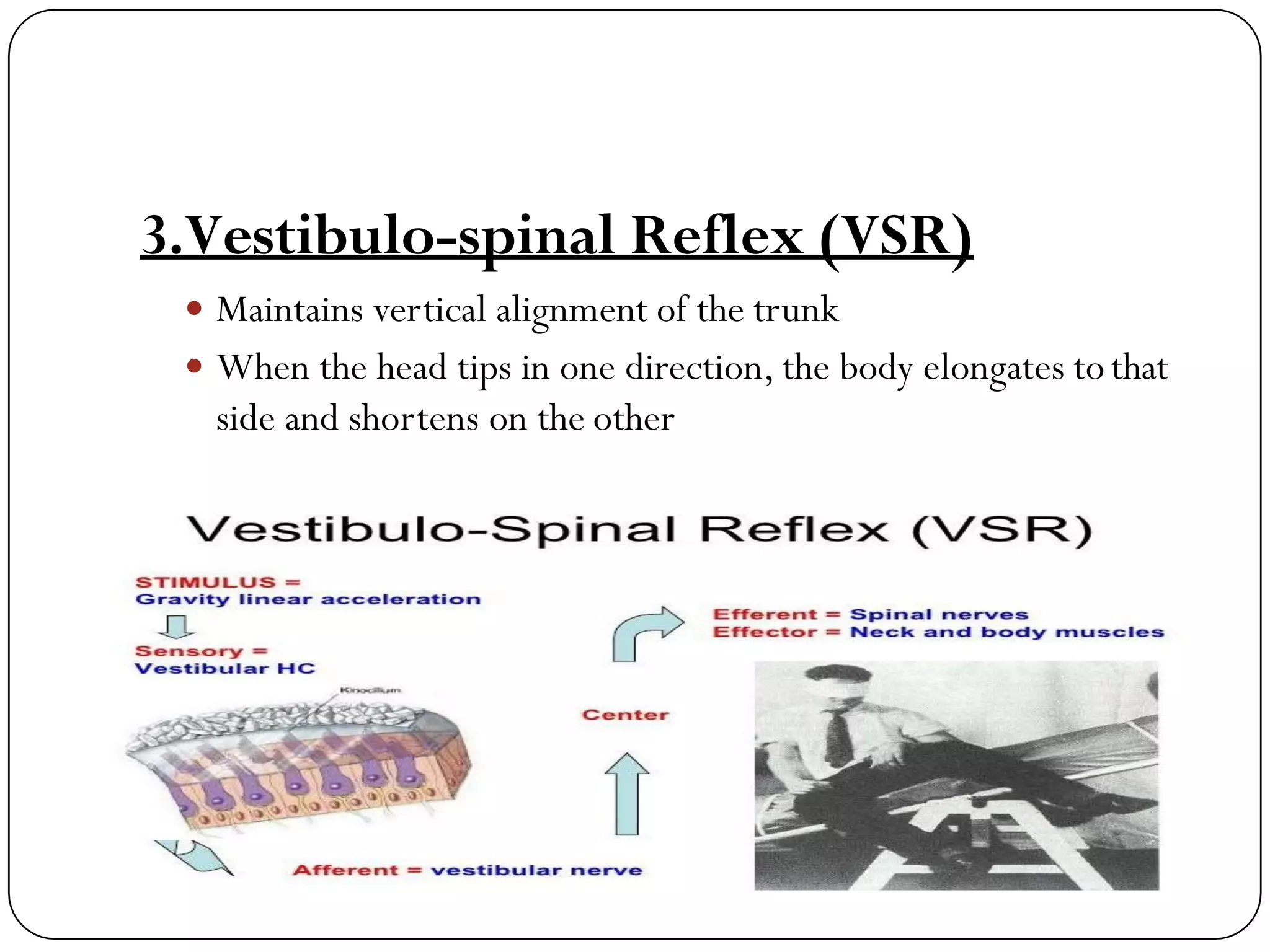 Vestibular dysfunctions | PDF